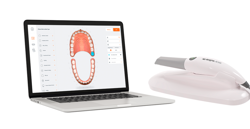 O que é 1 scanner dental? Aprenda como funciona | Dabi Atlante